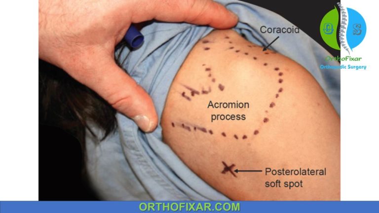 Subacromial Injection Test