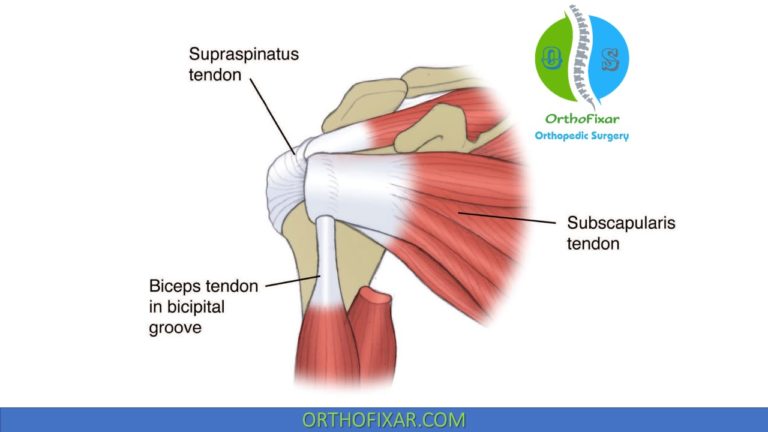 Internal Rotation Lag Sign Explained Easily | OrthoFixar