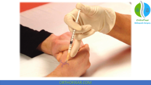 CMC Joint Injection