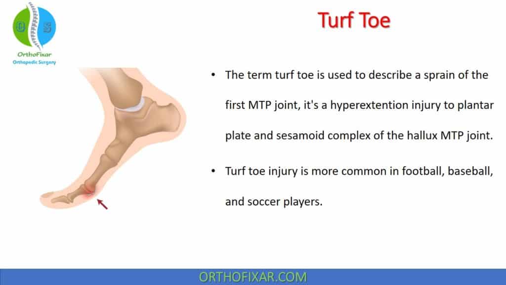 Myotomes Of The Upper Limb | OrthoFixar