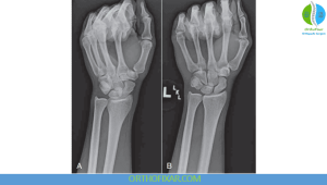 Wrist Radiology Imaging